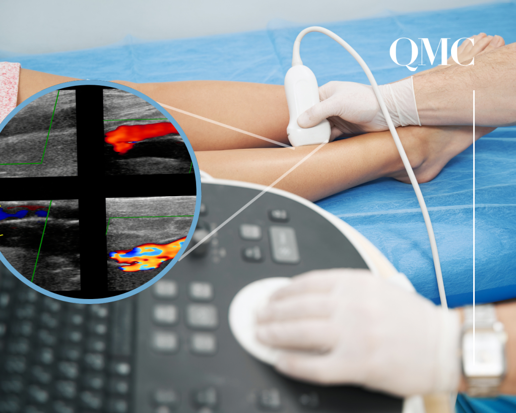 Color Doppler arterija i vena nogu - QMC